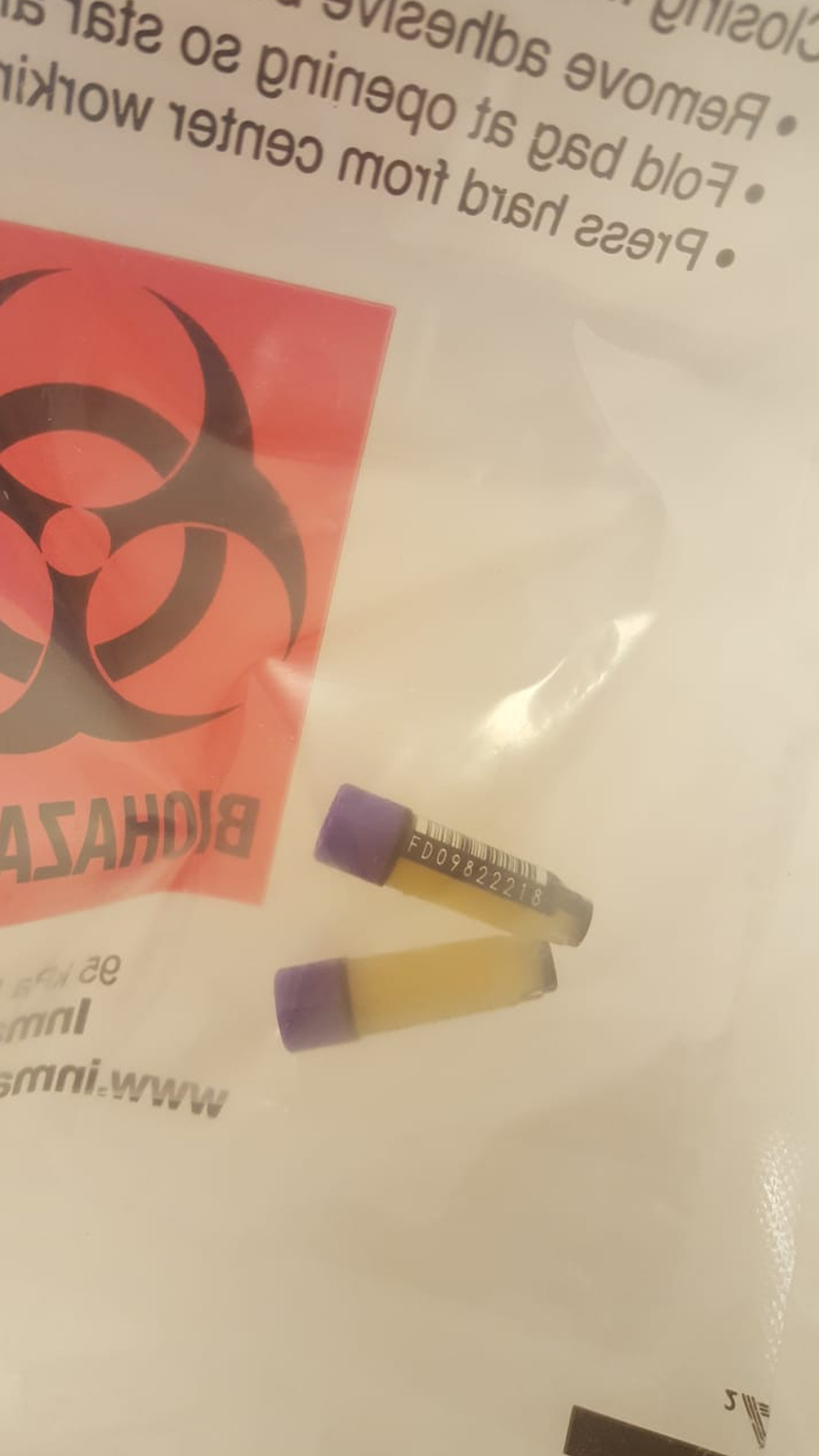 First patient screened for MELD-ATG